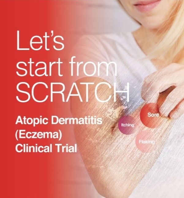 Atopic Dermatitis (Eczema)